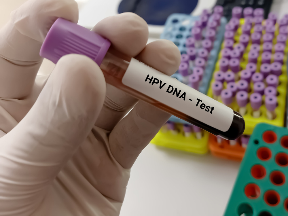 Greek health ministry dodges key questions over EU-funded HPV test ...