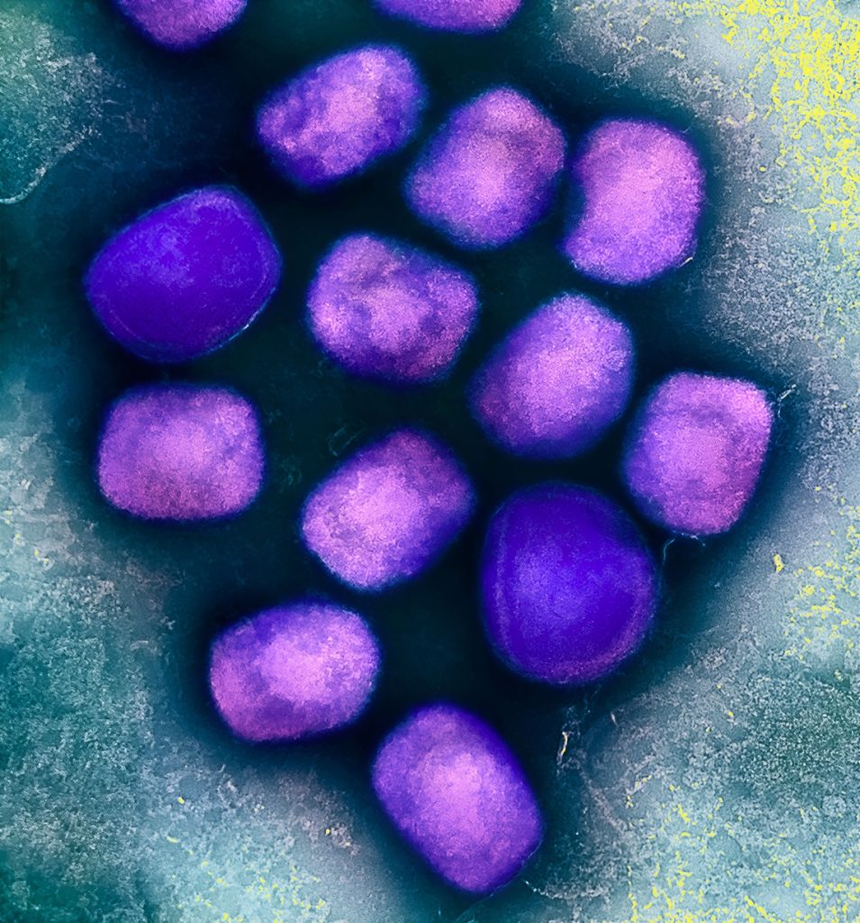 UK detects first case of new mpox variant | Euractiv